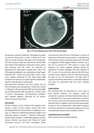Tubercular Brain Abscess: Diagnostic Dilemma-A Case Report | PDF