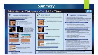 Tuberculin Skin Test (TST) Mantoux test.pdf