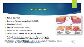 Tuberculin Skin Test (TST) Mantoux test.pdf