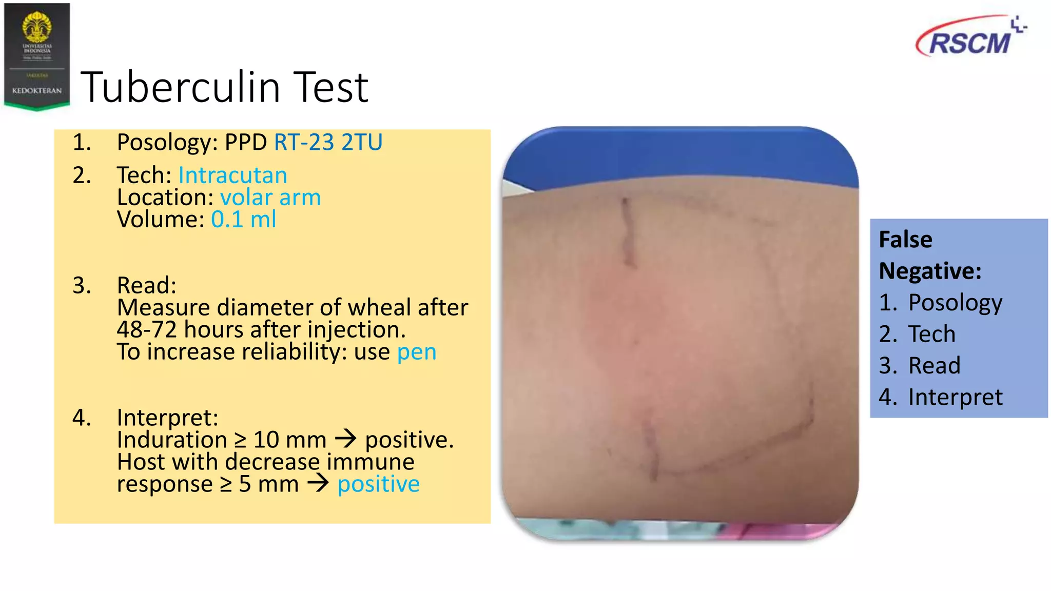 Tuberculin Test.pptx