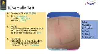 Tuberculin Test.pptx