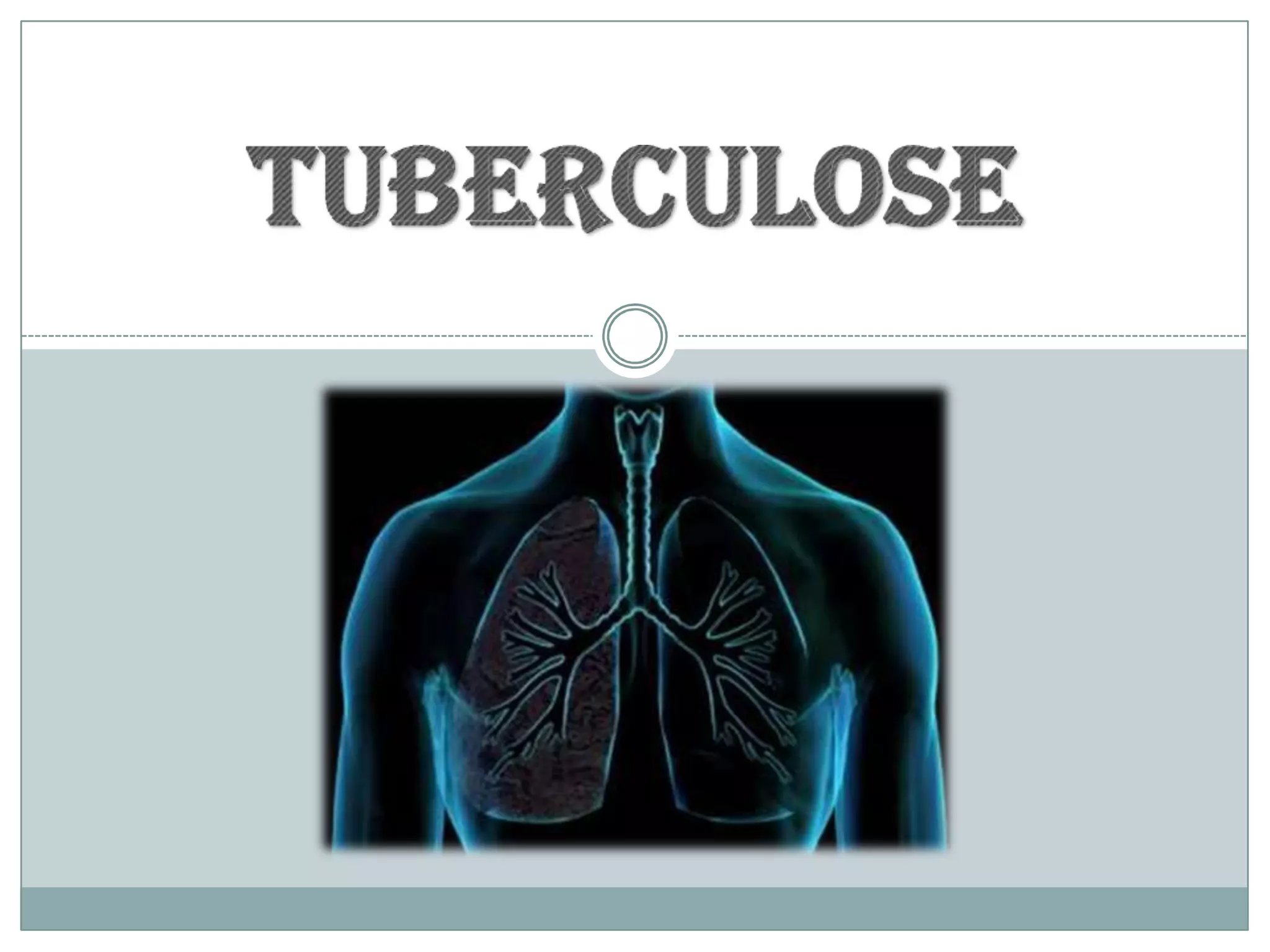 tuberculose - princípios e formas | PPT