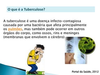Tuberculose | PPTX