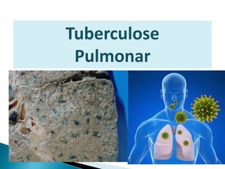Tuberculose | PPTX