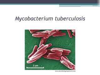 Aula em slides de Tuberculose 2023 v.2.pdf