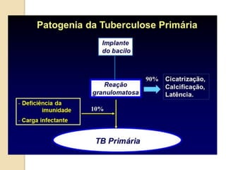 Tuberculose pulmonar | PDF