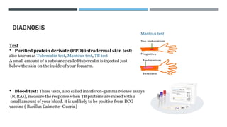 TUBERCULOSIS presentation by Almeen Ansari. | PPTX