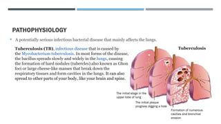 TUBERCULOSIS presentation by Almeen Ansari. | PPTX