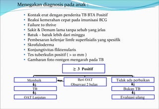 Tuberculosis | PPT
