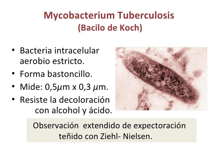 Tuberculosis