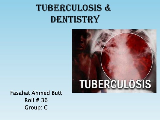 Tuberculosis and dentistry | PPTX | Dental Health | Diseases and Conditions