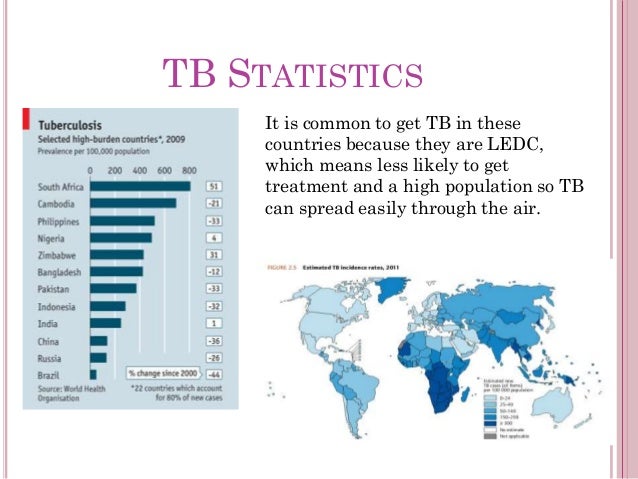 Tuberculosis