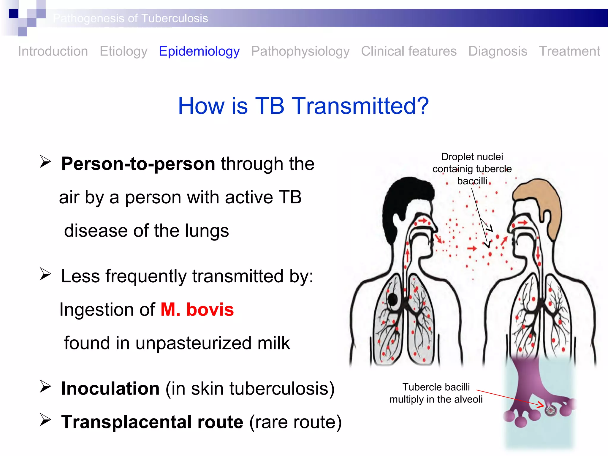 Pathogenesis of tuberculosis | PPT