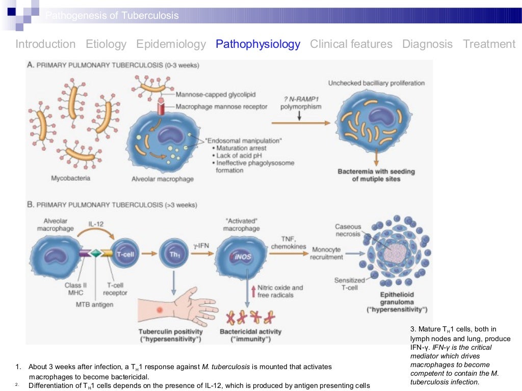 Pathogenesis of tuberculosis