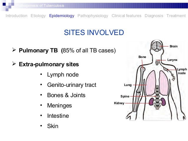 Pathogenesis Of Tuberculosis