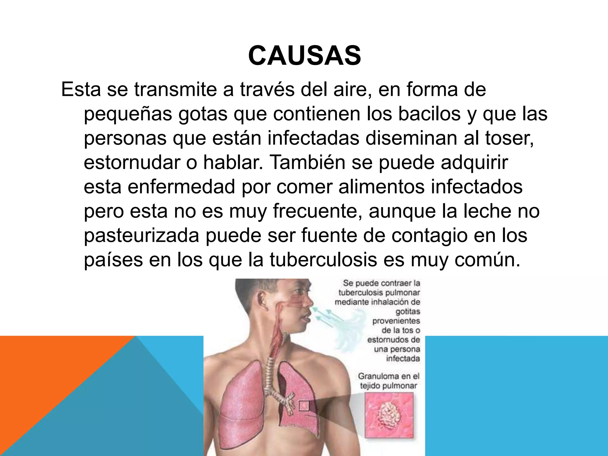 Tuberculosis | PPTX