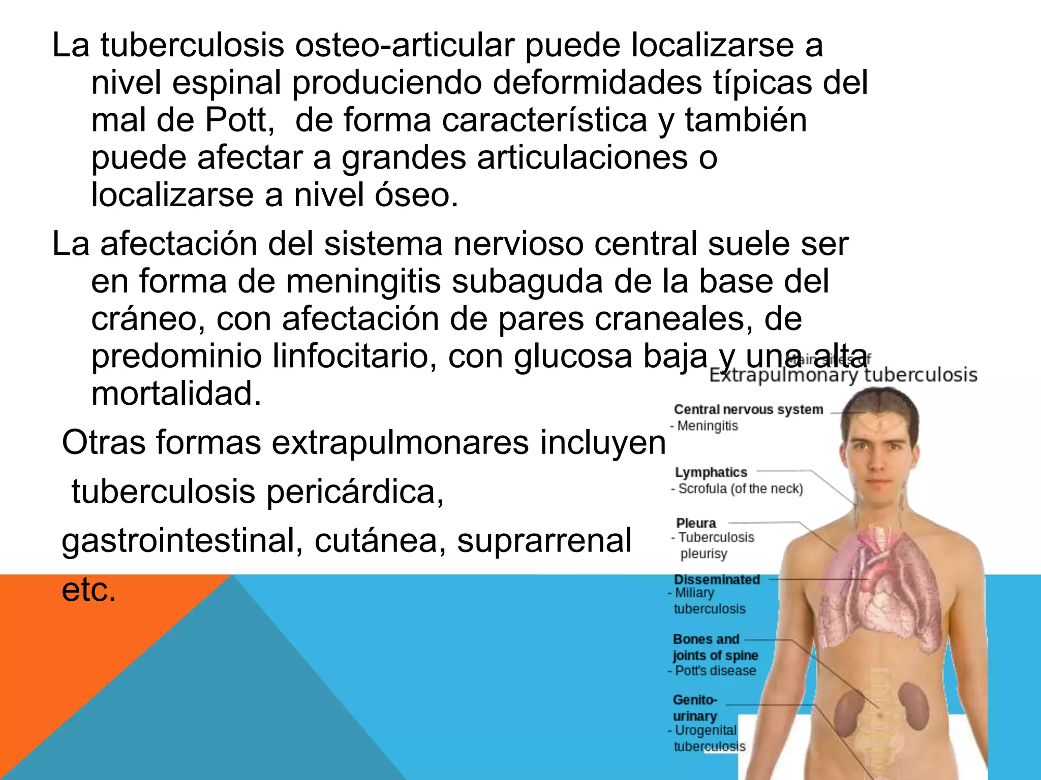Tuberculosis | PPTX