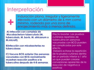 Tuberculosis | PPTX