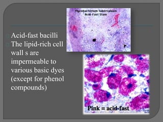 Tuberculosis | PPTX