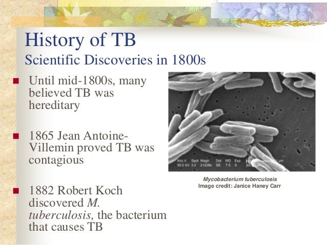 Tuberculosis