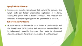 Classification and prophylactics of tuberculosis | PPTX