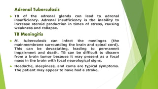 Classification and prophylactics of tuberculosis | PPTX
