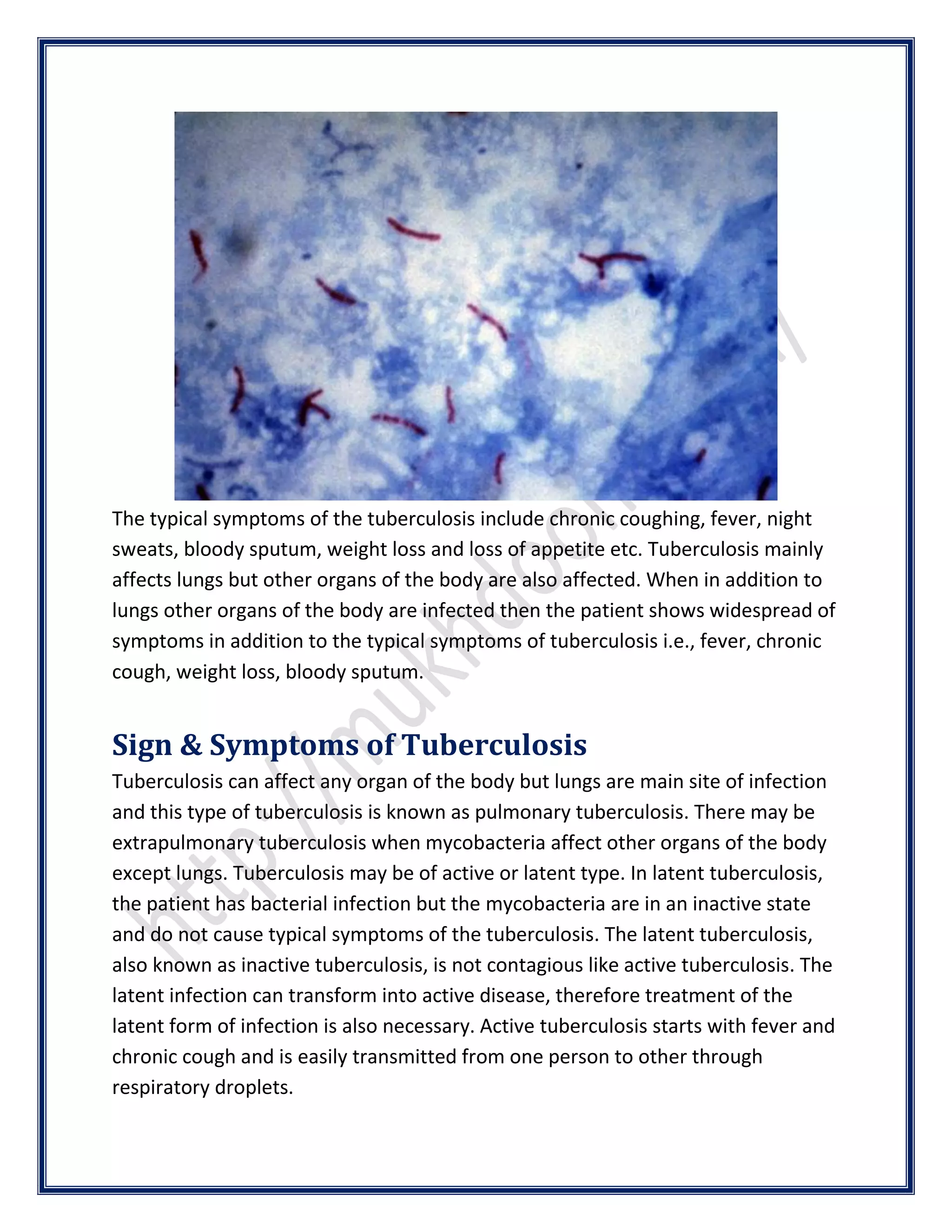 Tuberculosis | SurgicoMed.com