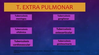 Tuberculosis | PPTX