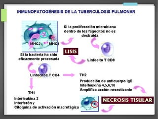 Tuberculosis | ODP