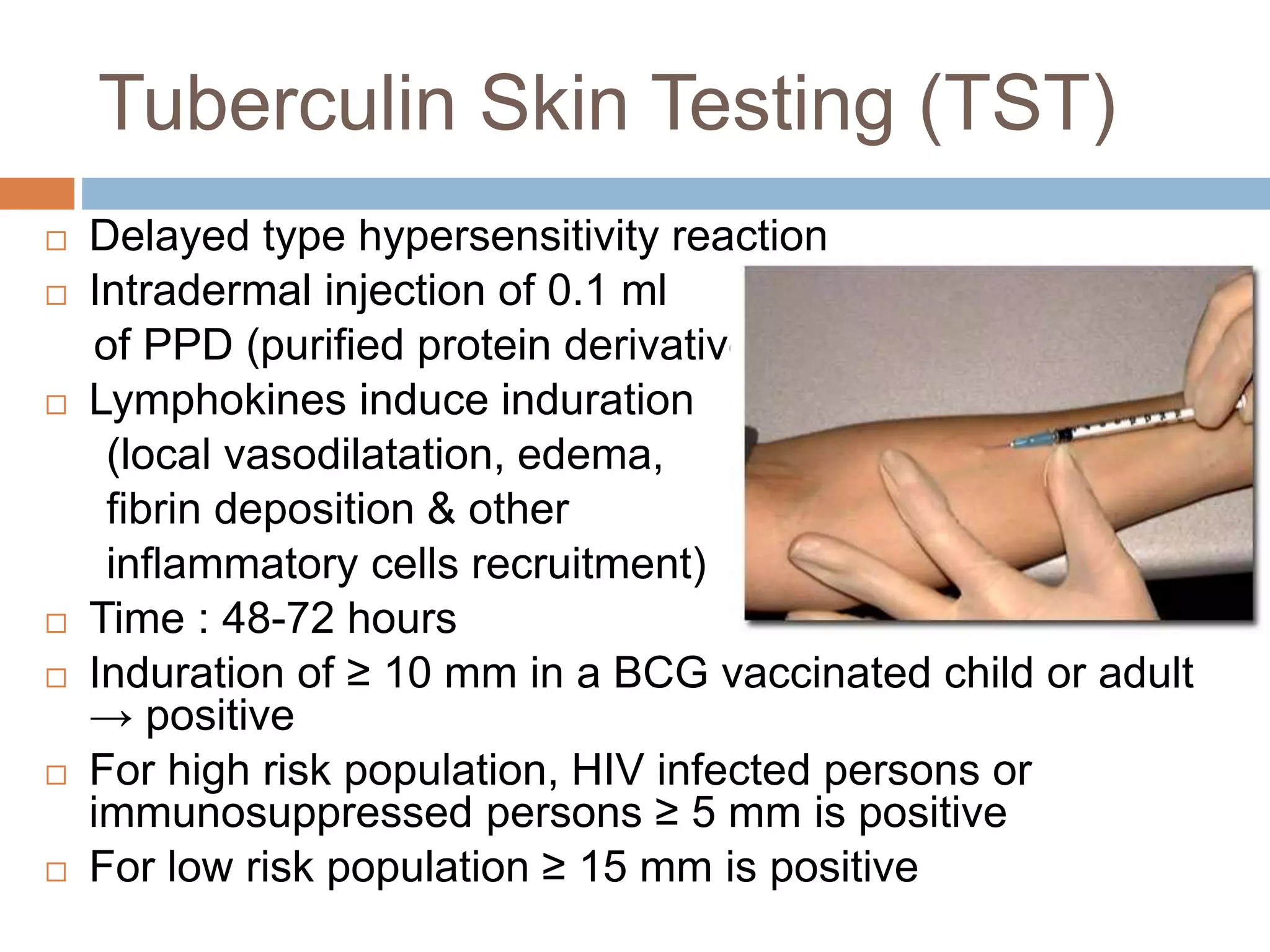 Tuberculosis | PPTX