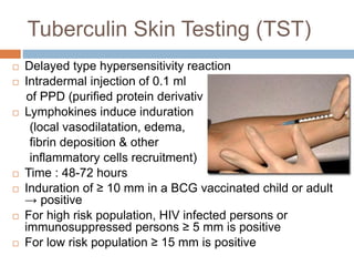 Tuberculosis | PPTX