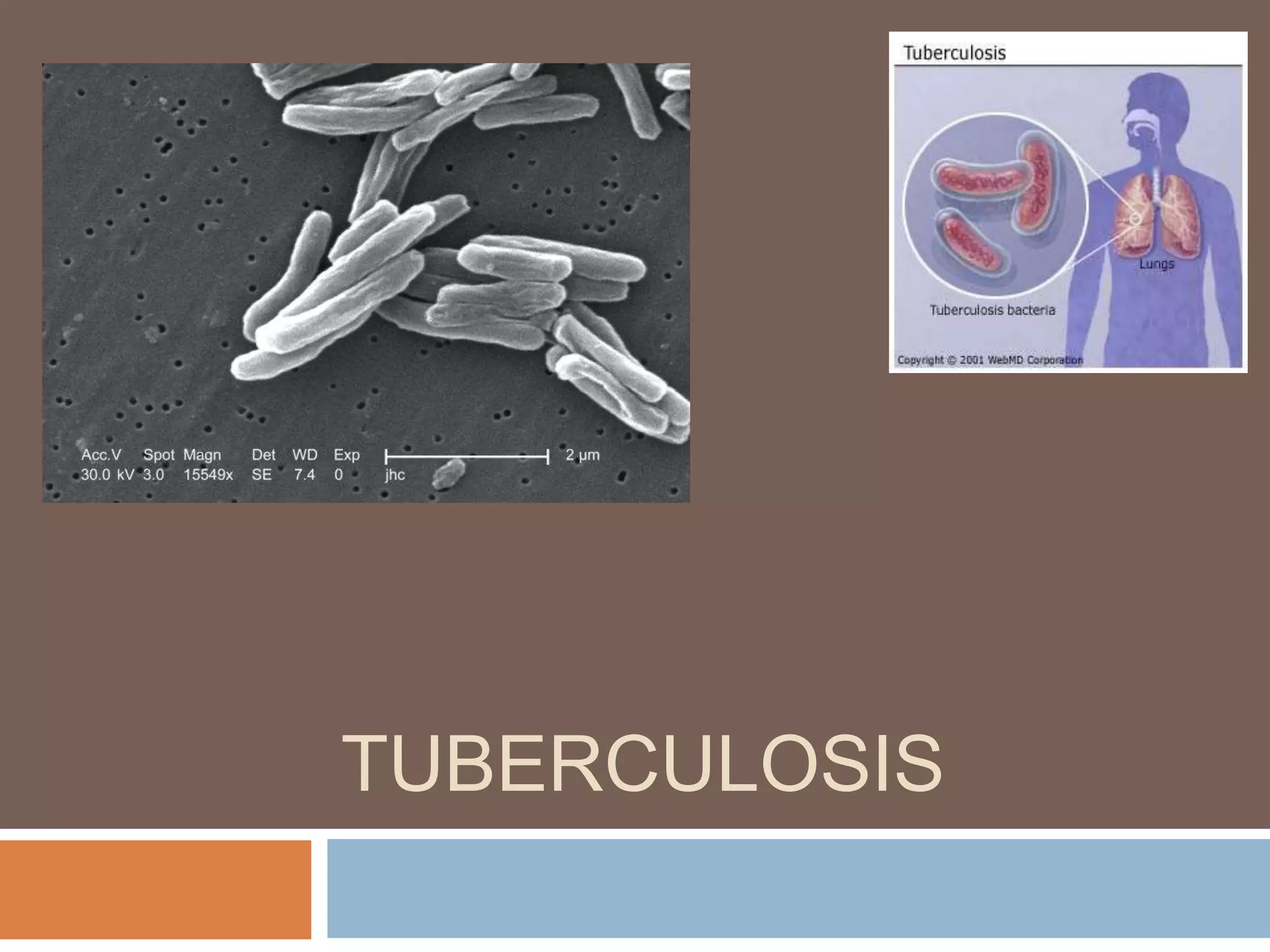 Tuberculosis | PPTX