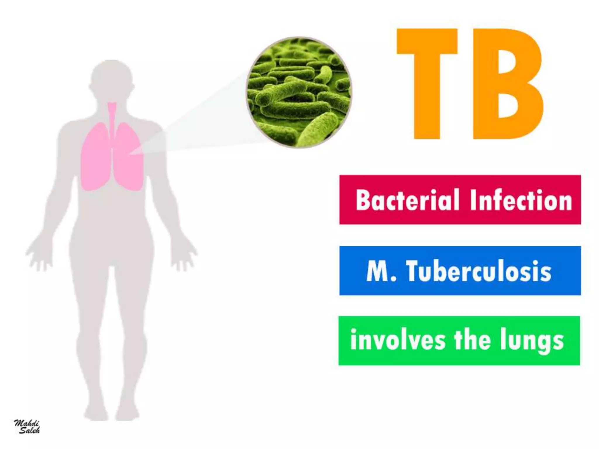 Tuberculosis | PPTX