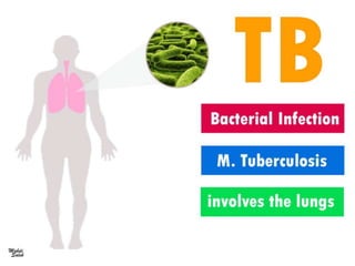 Tuberculosis | PPTX