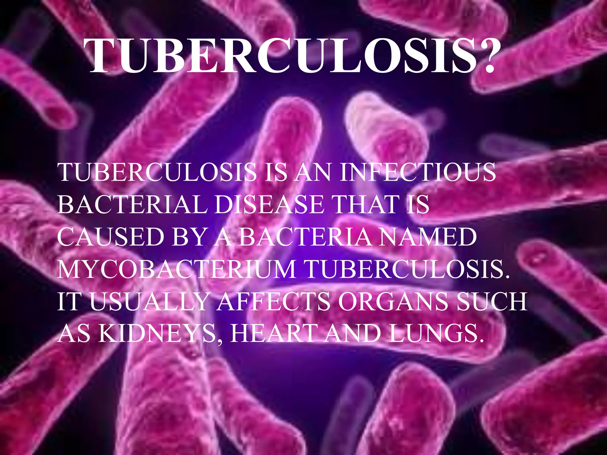 Austin Tuberculosis: Research & Treatment | PPTX | Lung and Respiratory ...