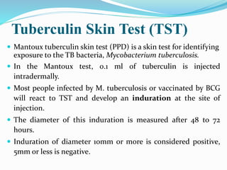 Tuberculosis | PPTX