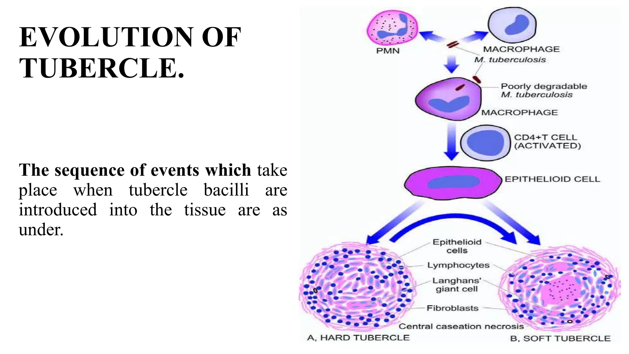 Pathophysiology of tuberculosis | PPTX
