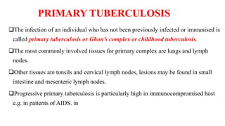 Pathophysiology of tuberculosis | PPTX
