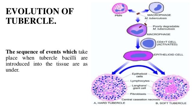 Pathophysiology of tuberculosis
