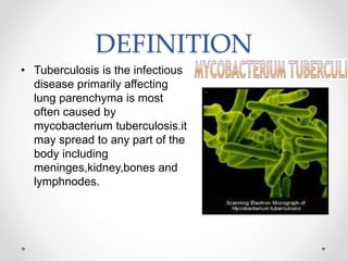 Tuberculosis | PPT