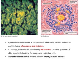 Mycobacterium tuerculae | PPT