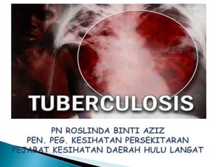 Tuberculosis slides | PPT