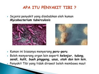 Tuberculosis slides | PPT