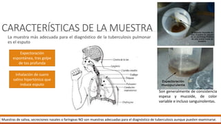 diagnostico bacteriológico de tuberculosis y micobacterias | PPTX