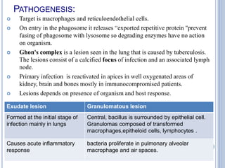 Tuberculosis | PPTX