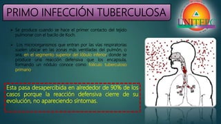 Tuberculosis | PPTX