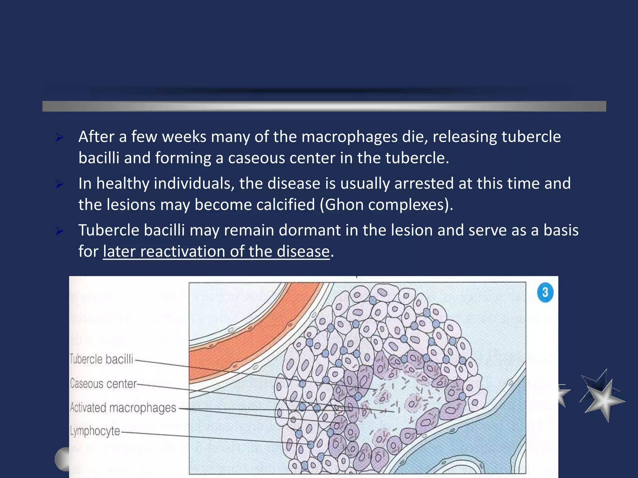 Tuberculosis | PPT