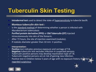 Tuberculosis | PPT