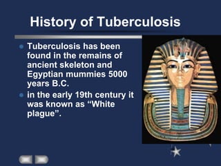 Tuberculosis | PPT
