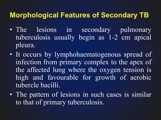 Tuberculosis | PPSX
